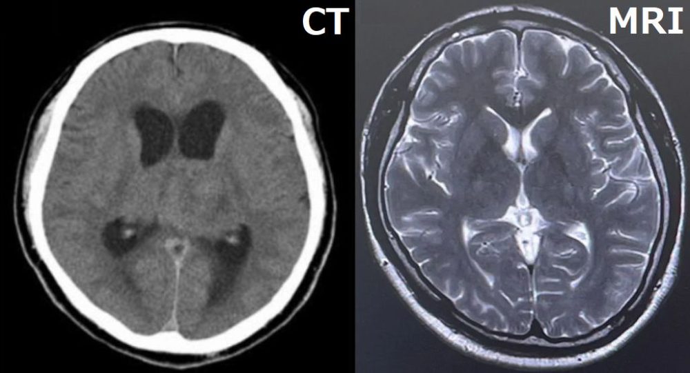 MRIとCTの違いとは？脳の検査はどっちが良い？ - 横濱もえぎ野クリニック 脳神経外科・脳神経内科